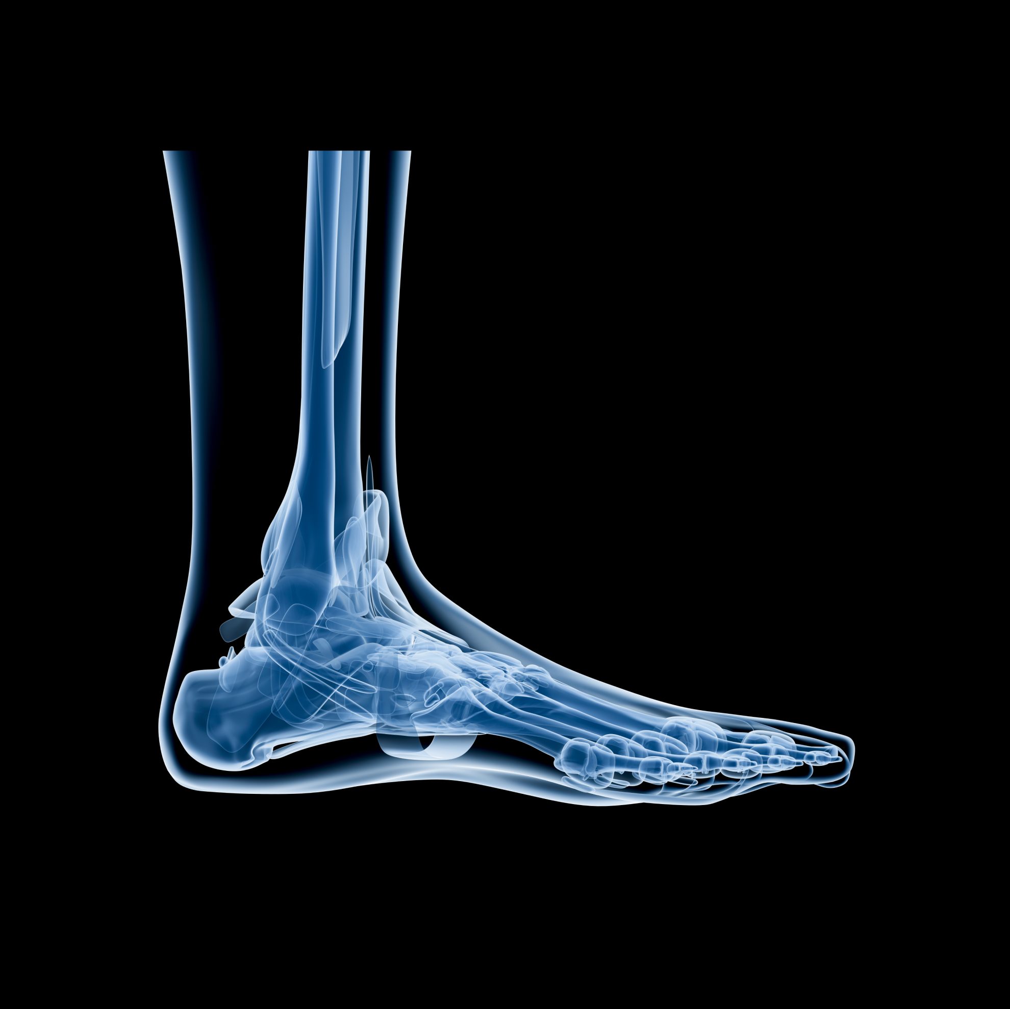 Hielspoor – Podologie Sarah Recour